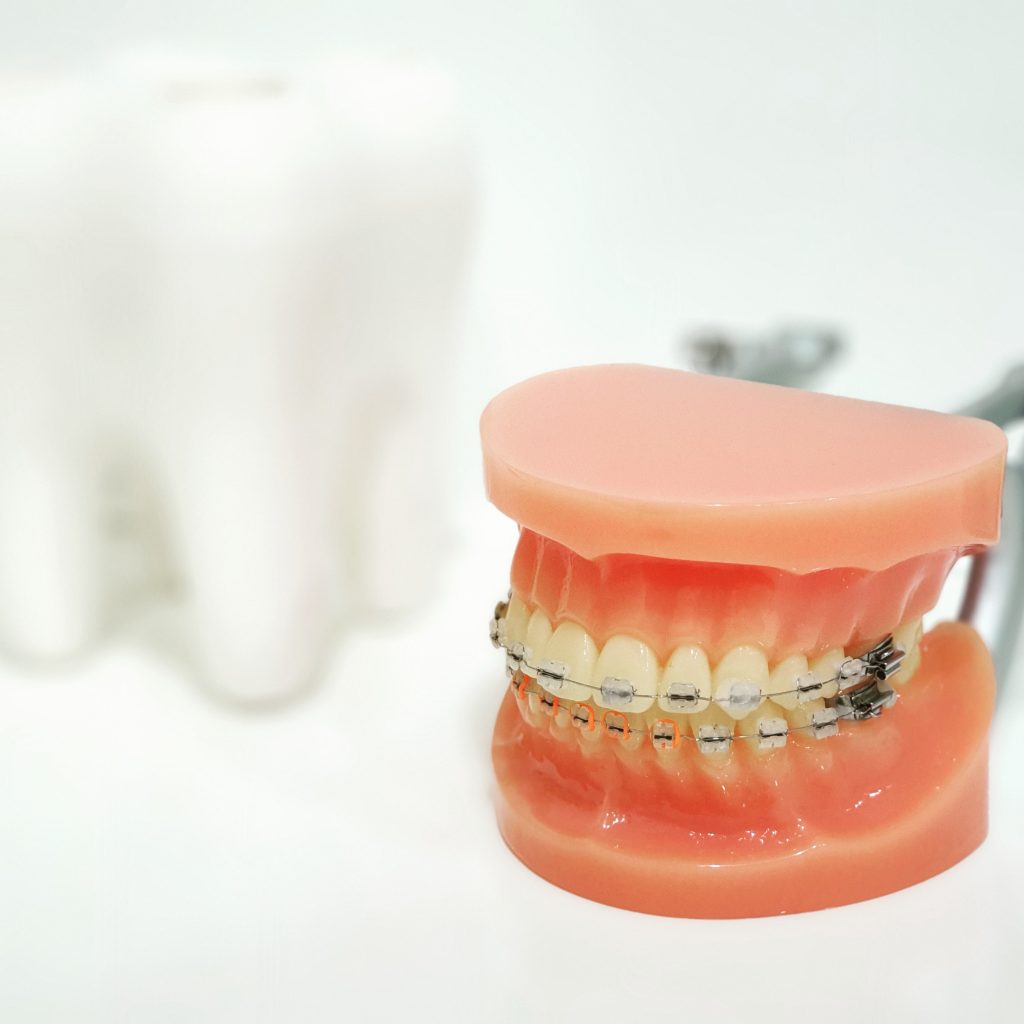 Braces Parramatta | Orthodontics Parramatta NSW